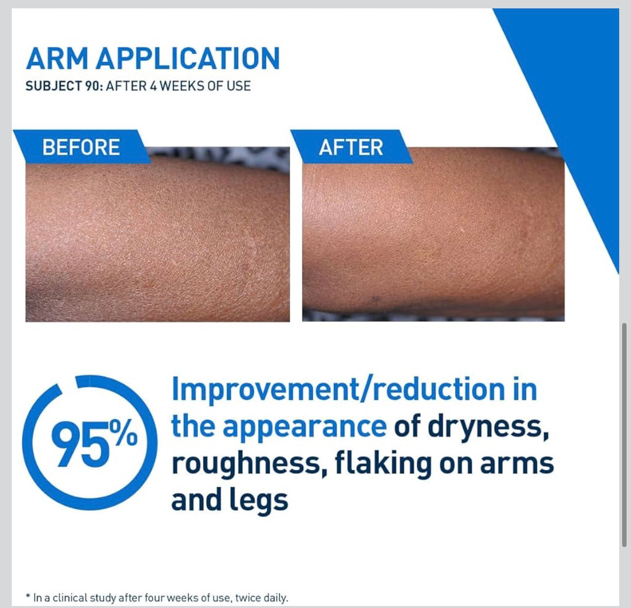 Cerave Intensive Moisturizing Lotion 5% Hydro Urea – Nancy Jarufe Studio